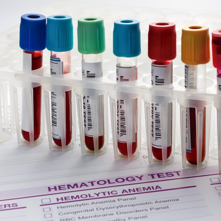 Introduction to Hematology - Asumed Health Care